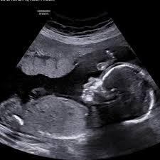 Le développement de votre bébé à 22 semaines